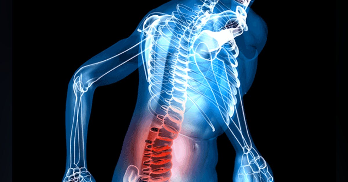 A brief look at musculoskeltal injuries - Falcon Health